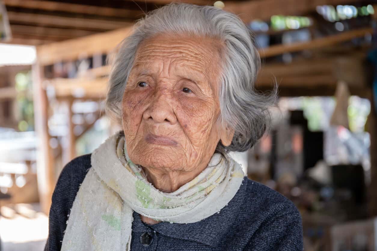 What Are Elderly Skin Unique Needs And How To Provide Skin care